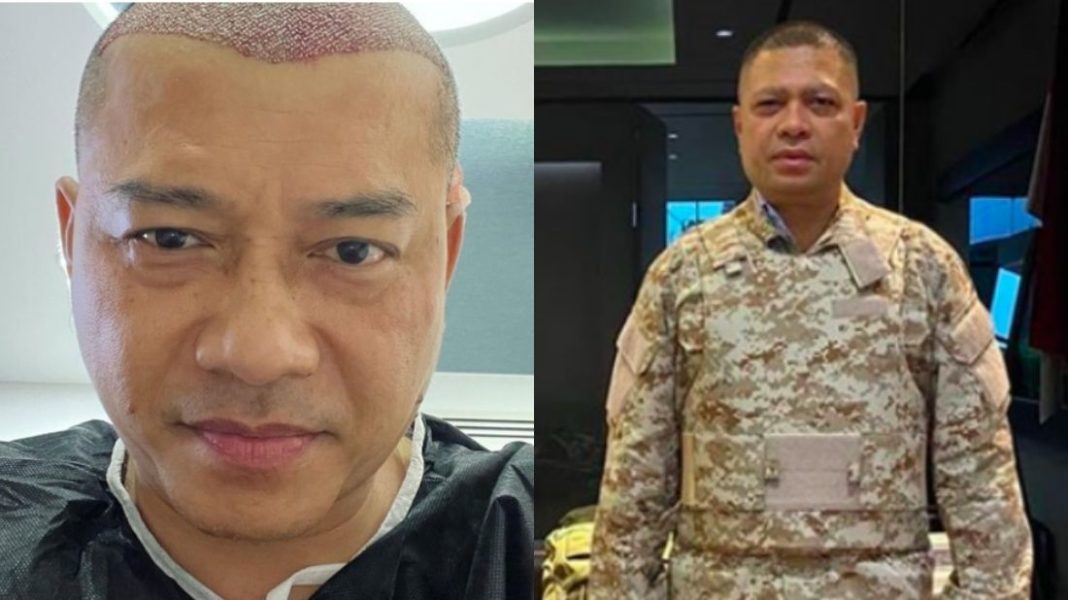 Gara-gara Unggah Foto Saat Cangkok Rambut, Anang Hermansyah Disebut ...