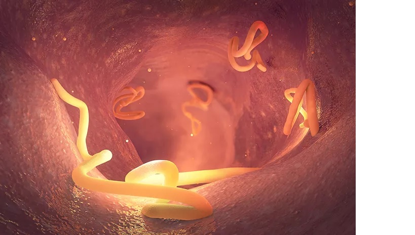 Sudah Tahu Apa Itu Cacingan? Simak Ini Penjelasan Praktisi Kesehatan ...